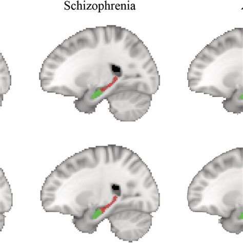 Hippocampal Functional Divisions Anterior And Posterior Hippocampus In Download Scientific