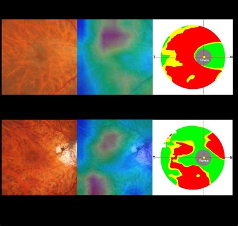 Cam Visualization Of Cm Images Download Scientific Diagram