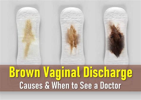 What Does Brown Discharge Mean Common Causes And When To See A Doctor