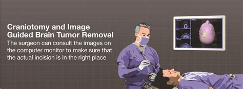 Image Guided Surgery Steps