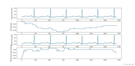 超入门级 基于中值滤波处理ecg信号的基线漂移 Python Mit Bih数据集中值滤波去除基线漂移 Csdn博客