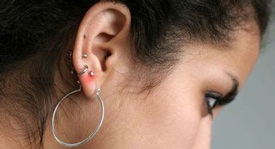 Infected Ear Cartilage Piercing
