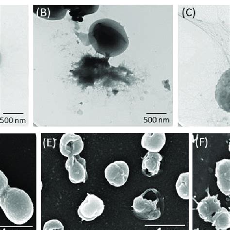 Transmission Electron Microscope Tem And Scanning Electron Microscopy Download Scientific