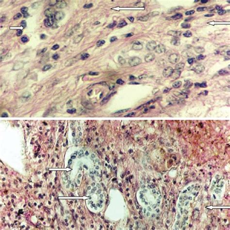 Photomicrograph Of 3 Microns Thick H And E Stained Paraffin Section From Download Scientific
