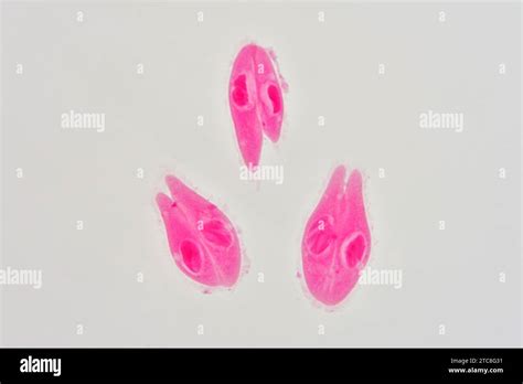 Paramecium Or Paramoecium In Conjugation Optical Microscope X200 Stock