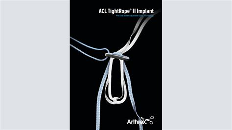 Arthrex Tightrope® Ii Attachable Button System
