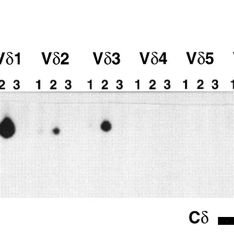 Semi Quantitative Pcr Using 5′ Primers Specific For Vδ1vδ6 Or Cδ And A