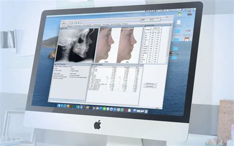 Dr Ceph Custom Desktop Applications Scopic