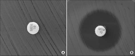 Interpretation Of Carbapenem Inactivation Method Cim The Positive