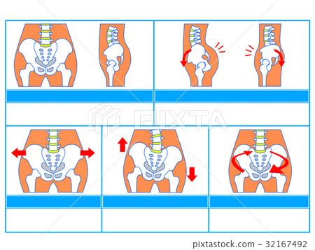 Pelvic Distortion Classification Figure Stock Illustration PIXTA