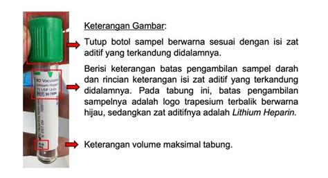 Pemilihan Tabung Sampel Pada Pemeriksaan Patologi Klinik Darah Alomedika
