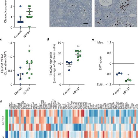 Netrin 1 Blockade Inhibits Endometrial Adenocarcinoma Progression In Download Scientific