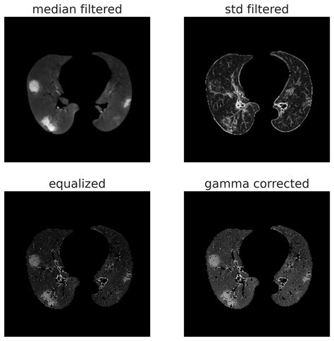 COVID Lung Segmentation CTLungSeg Documentation