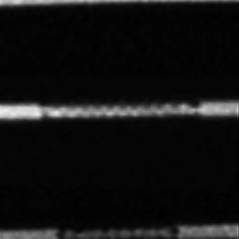 Static Artifact Appearance On Series 3 Coronal Orientation 3t Trte Download Scientific
