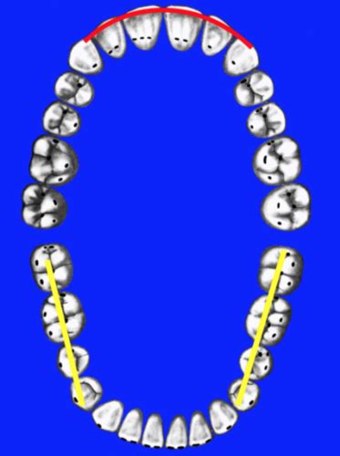 Physiologic Tooth Form Flashcards Quizlet