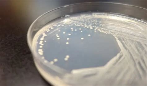Scientists Construct A Synthetic Yeast Genome
