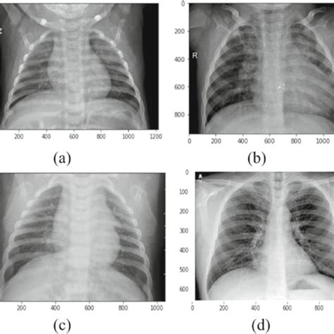 output of gradient weighted class activation mapping gradcam