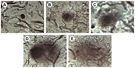 Classification Of G Roeseli Hemocytes In The Comet Assay According To