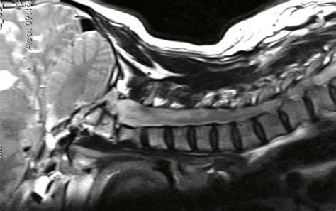 Banana Mri Tag PrimoGIF