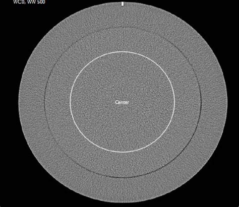Representative Image For Evaluating Noise Obtained With The Catphan Download Scientific Diagram