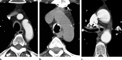 Ct Scans Demonstrate Pathologic Conditions That May Manifest With