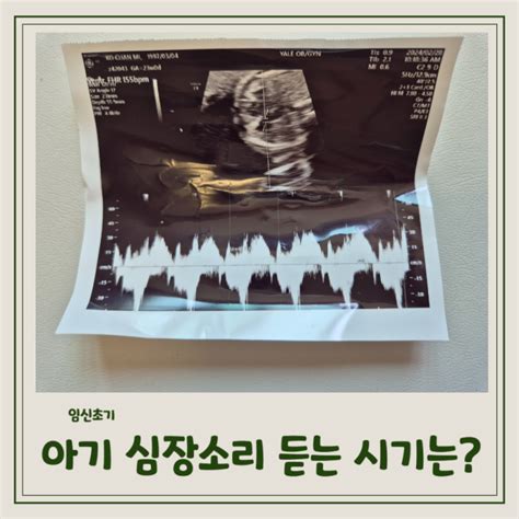 임신 56주 차 아기 심장소리 듣는 시기는 심장소리로 알아보는 성별확인법 네이버 블로그