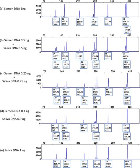 Electropherogram For One Example Of Dna Mixtures Tested By The Download Scientific Diagram