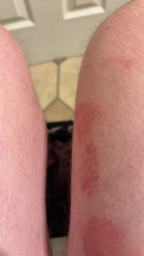 Explosion Video Thisvid Com