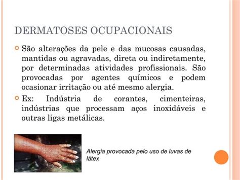 Aula 3 Doenças Ocupacionais Ppt