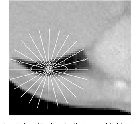 Figure 1 From Tensor Scale An Analytic Approach With Efficient