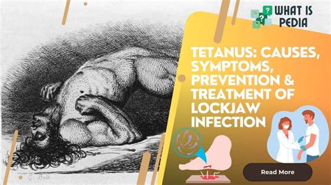 Tetanus Causes Symptoms And Treatment Guide