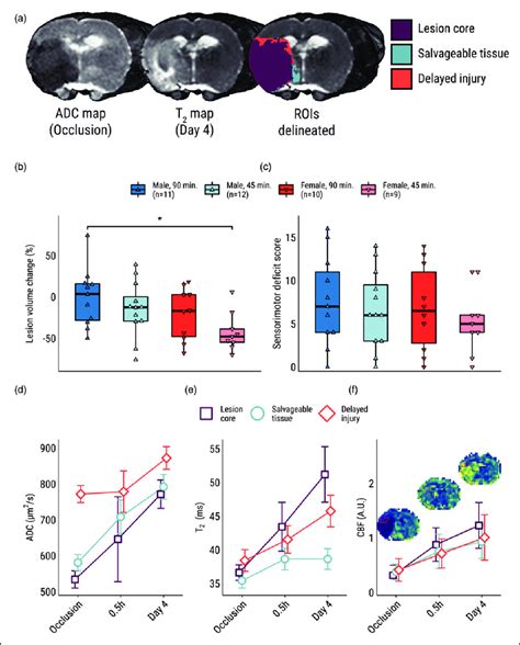 Outcomes Of Cerebral Ischemia Reperfusion On Mri And Behavioral Download Scientific Diagram