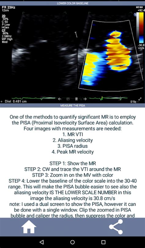 Learn The Full Tte Echo Ultrasound Protocol Demo For Android Download