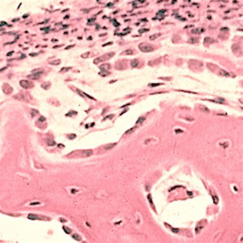 Bone Development Intramembranous Ossification Tutorial Sophia Learning