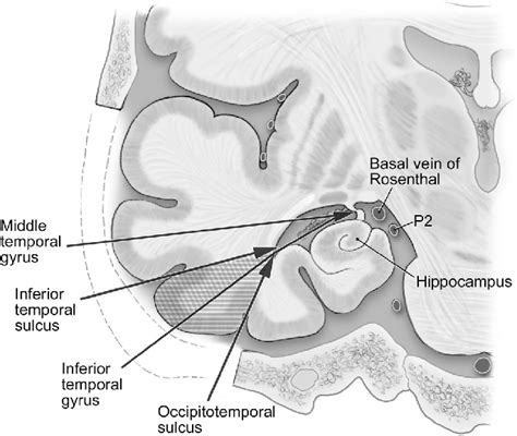 Inferior Temporal Sulcus
