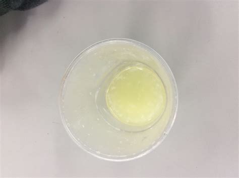 Extracting DNA From Onions