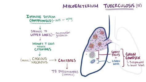 Tuberculosis Tb Infections Msd Manual Consumer Version