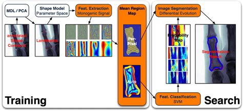 1 flowchart of the proposed improved shape particle filter landmarks