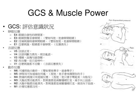 Ppt 動脈瘤術後照顧 Powerpoint Presentation Id3369662