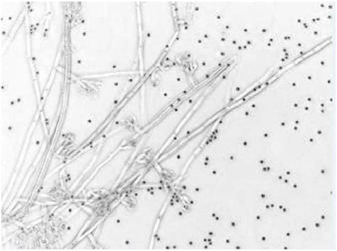 Trichoderma Viride Strain And Application Thereof Eureka Patsnap