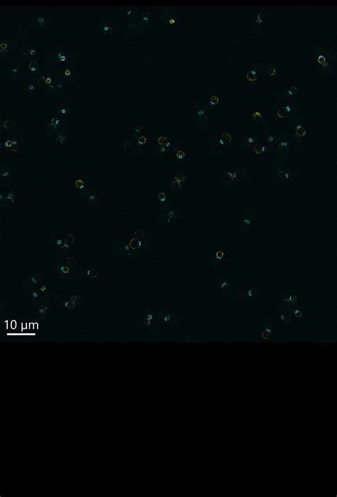 Dragonfly Confocal Microscope System Andor Oxford Instruments