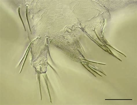 Male Genitalia In Lateral View The Three Genital Lobes Are Nearly Download Scientific Diagram
