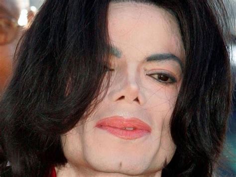 Colapso De Nariz De Michael Jackson