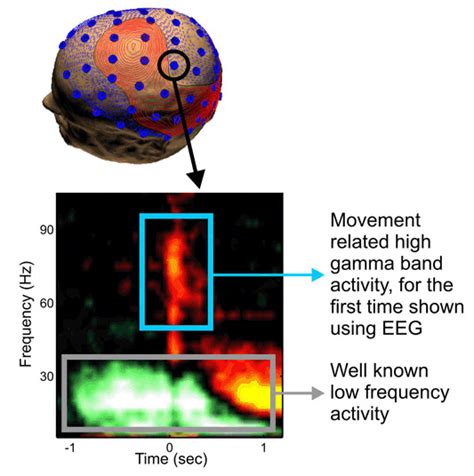 Invasive Non Invasive EEG Interrelations Ieeg