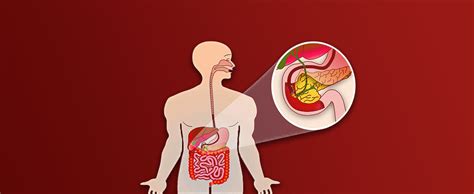 Ercp چیست؟ بیمارستان مرتاض یزد