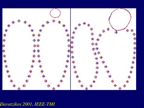 Ppt Measuring Anatomy And Its Deformation Using Deformable Shape