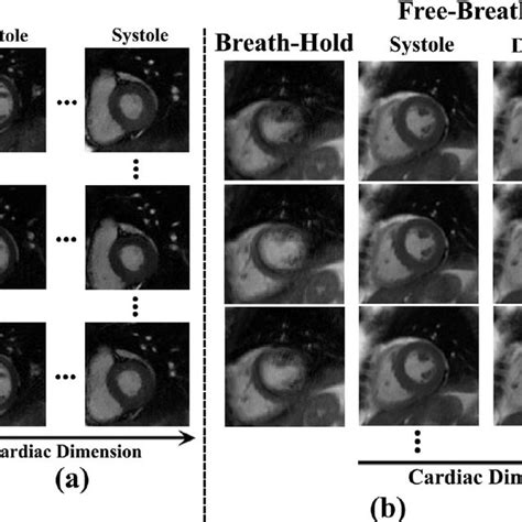 A Cardiac Cine Imaging With Cardio Respiratory Synchronization In The Download Scientific