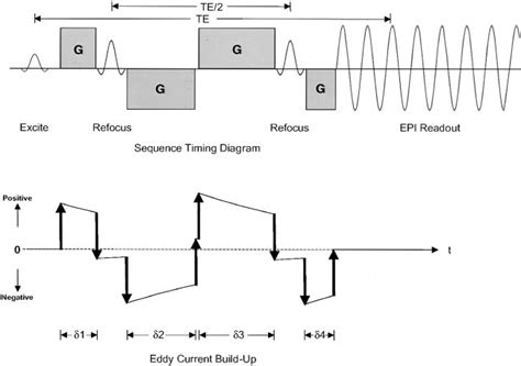 18 Timing Diagram Of The Diffusion Weighted Tsre Sequence Note That Download Scientific
