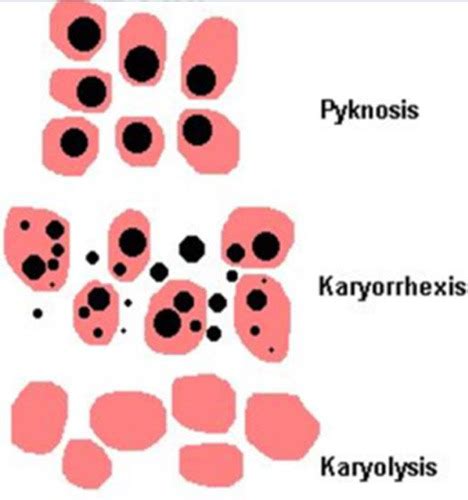 Pp Cell Injury And Cell Death Flashcards Quizlet