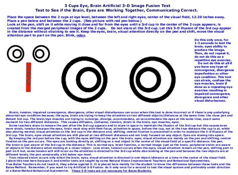 Muscle Exercises Eye Muscle Exercises For Double Vision
